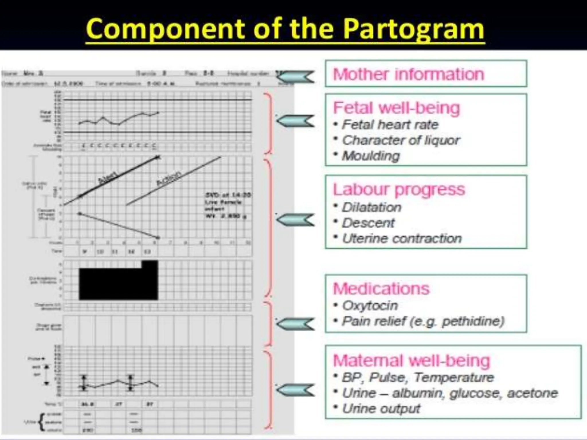partograph in intranatal period of obstetrics | PPT
