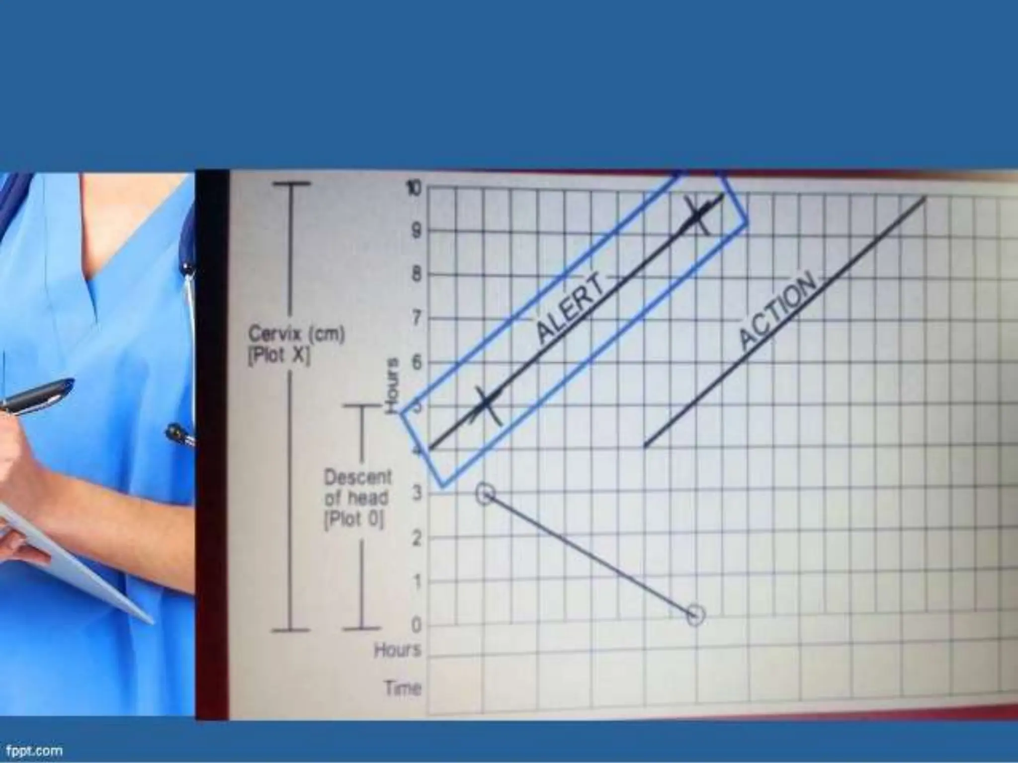 partograph in intranatal period of obstetrics | PPTX