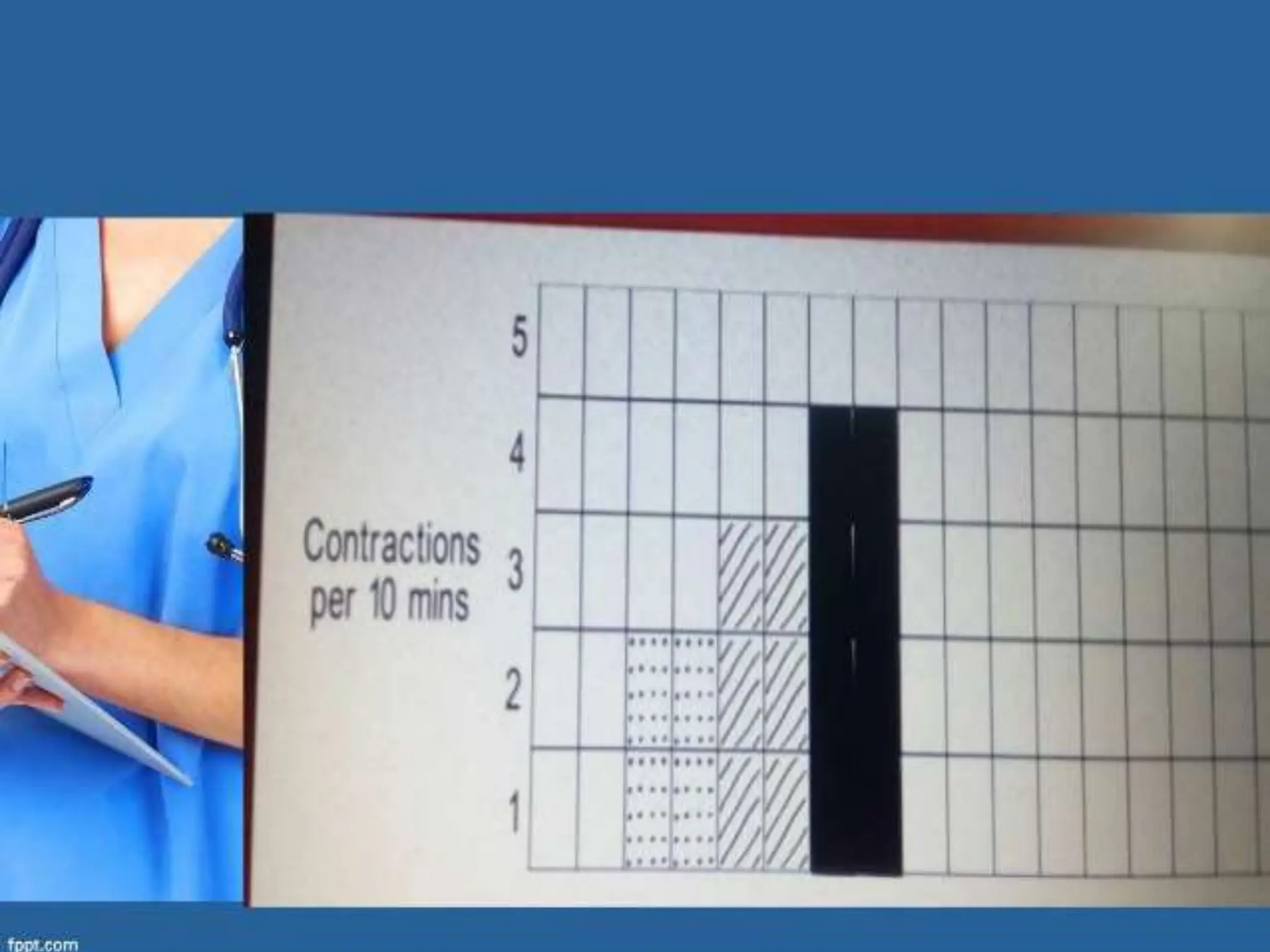 partograph in intranatal period of obstetrics | PPTX