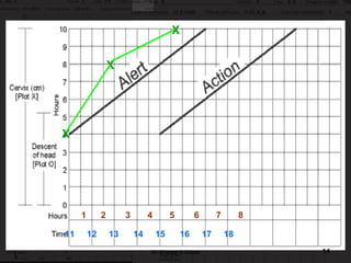 partograph guide through with images included | PPT