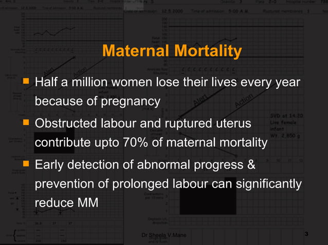 partograph guide through with images included | PPT