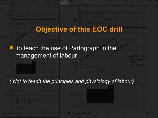 partograph guide through with images included | PPT