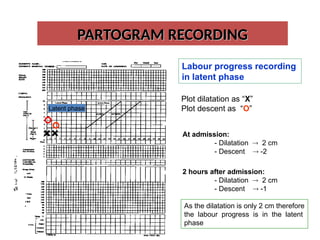 PARTOGRAPH... RECORDING AND PROCESS.ppt