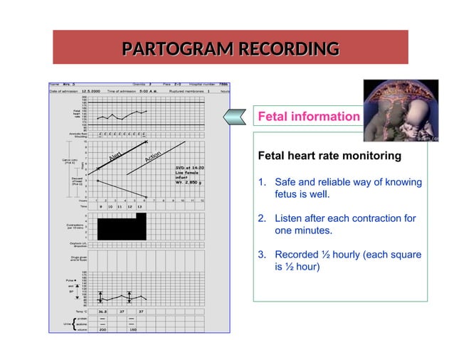 PARTOGRAPH... RECORDING AND PROCESS.ppt