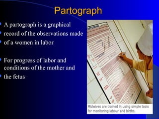 Partograph and labor dystocia for undergraduate | PPT