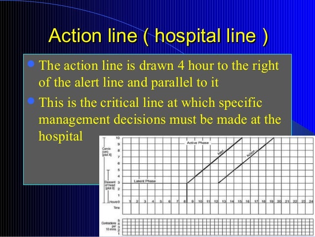 Partograph and labor dystocia for undergraduate