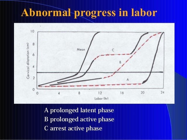 Partograph and labor dystocia for undergraduate