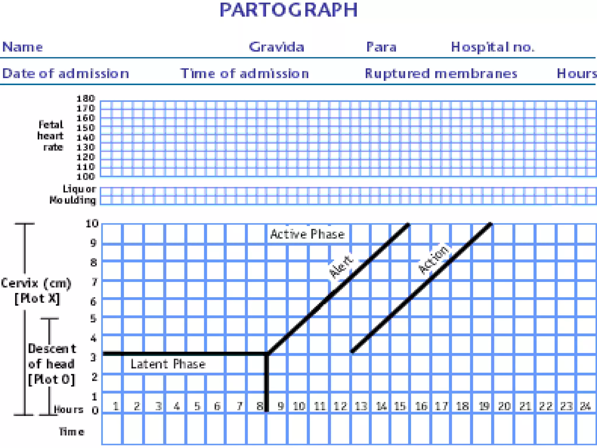 LABOUR MONITORING BY PARTOGRAPH BY DR SHASHWAT JANI | PPTX