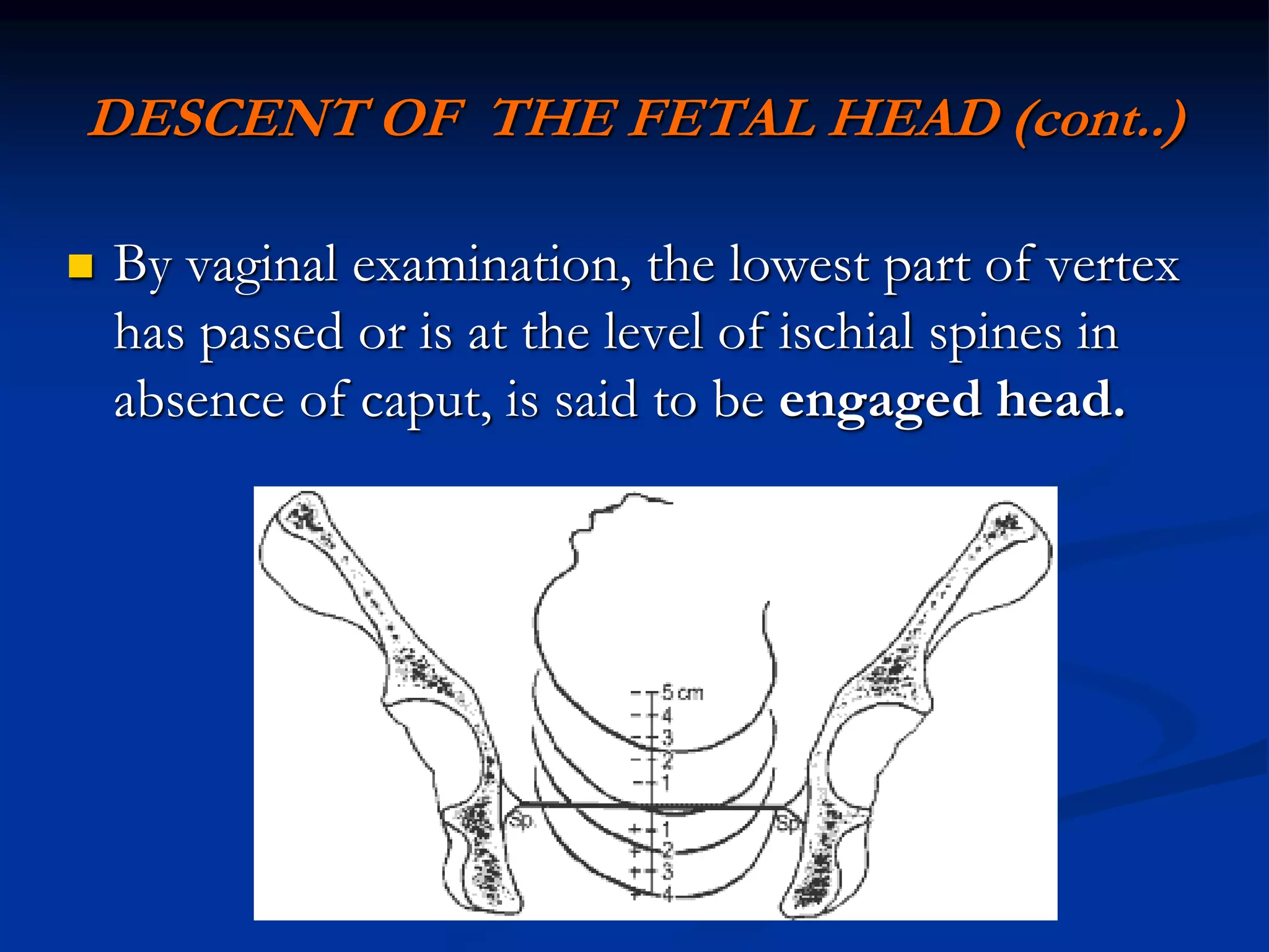 LABOUR MONITORING BY PARTOGRAPH BY DR SHASHWAT JANI | PPTX