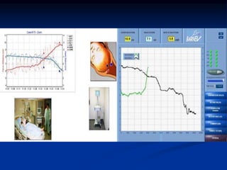 LABOUR MONITORING BY PARTOGRAPH BY DR SHASHWAT JANI | PPTX