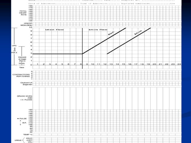 LABOUR MONITORING BY PARTOGRAPH BY DR SHASHWAT JANI