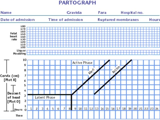 LABOUR MONITORING BY PARTOGRAPH BY DR SHASHWAT JANI