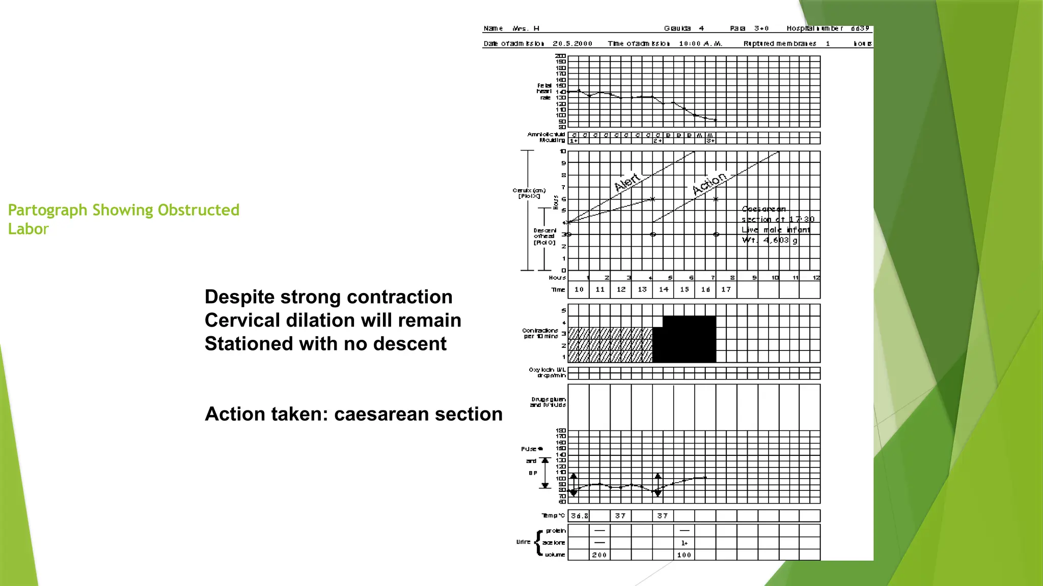 PARTOGRAPH DR SILWAMBA and DR TEMBO.pptx