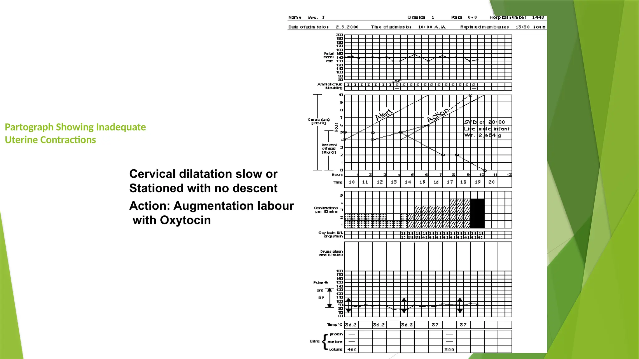 PARTOGRAPH DR SILWAMBA and DR TEMBO.pptx