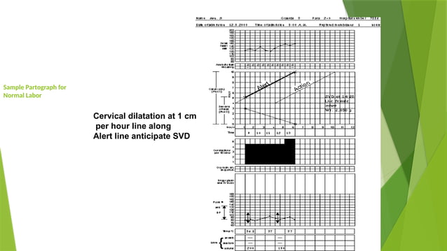 PARTOGRAPH DR SILWAMBA and DR TEMBO.pptx