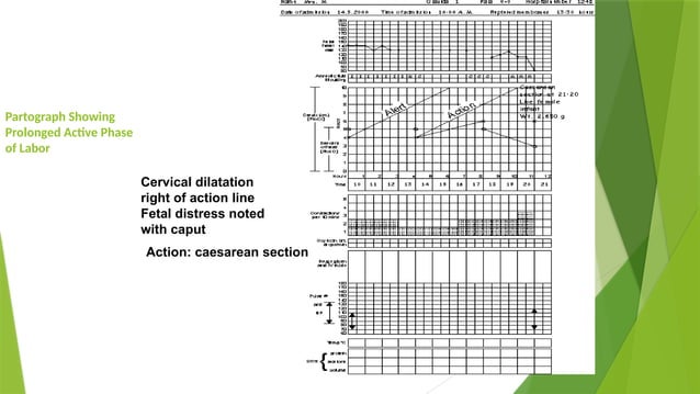 PARTOGRAPH DR SILWAMBA and DR TEMBO.pptx