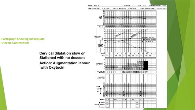 PARTOGRAPH DR SILWAMBA and DR TEMBO.pptx