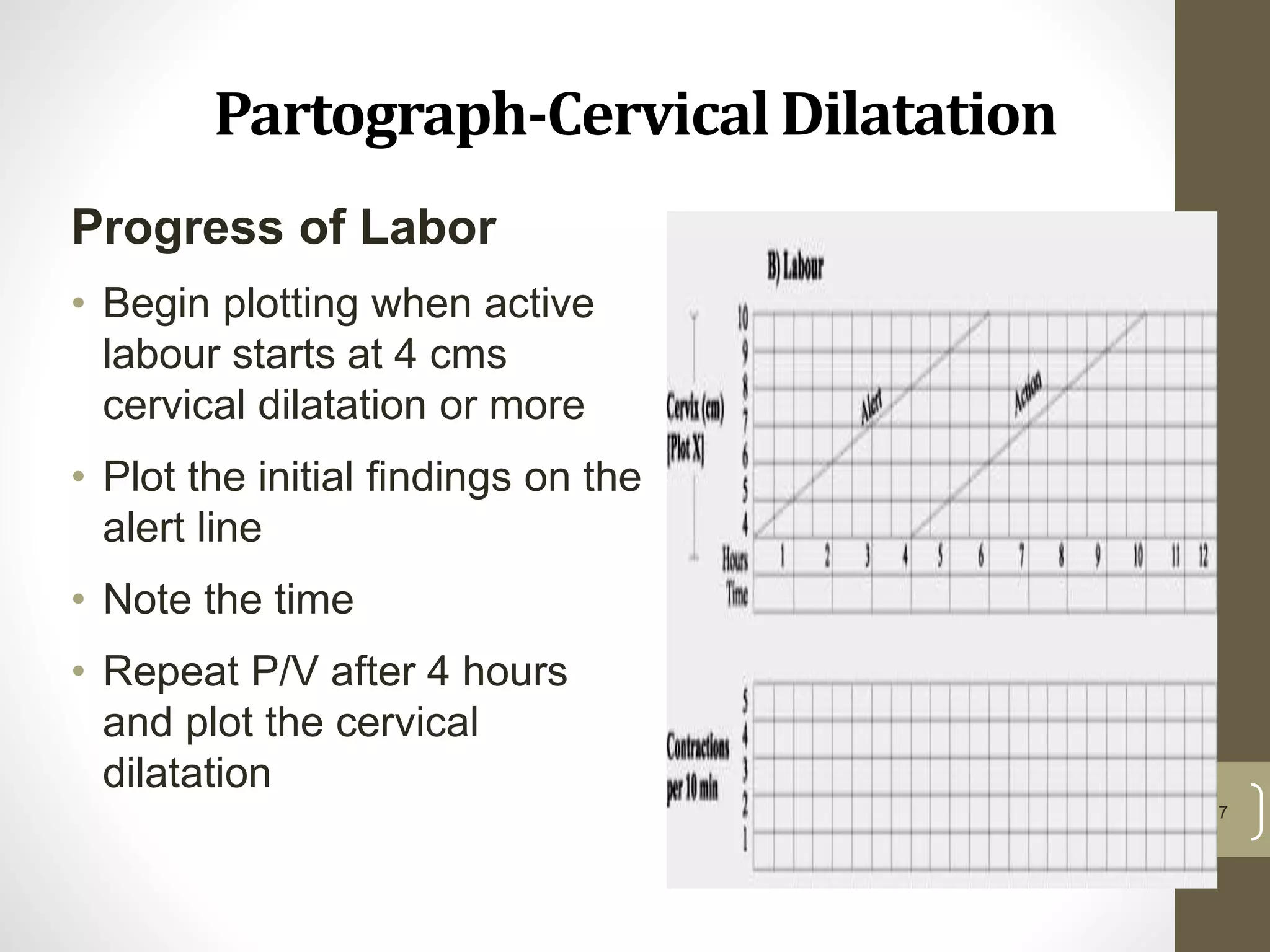 PARTOGRAPH FOR BEGINEERS | PPTX