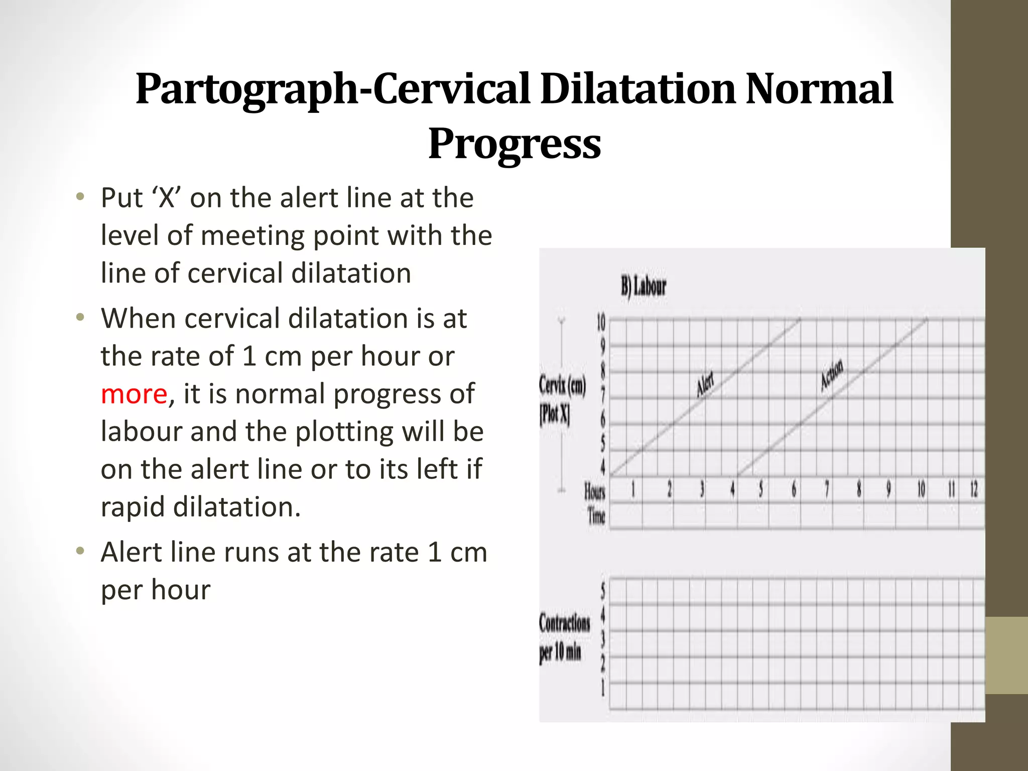 PARTOGRAPH FOR BEGINEERS | PPTX