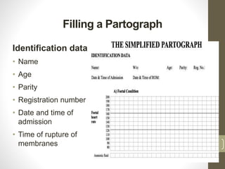 PARTOGRAPH FOR BEGINEERS | PPTX
