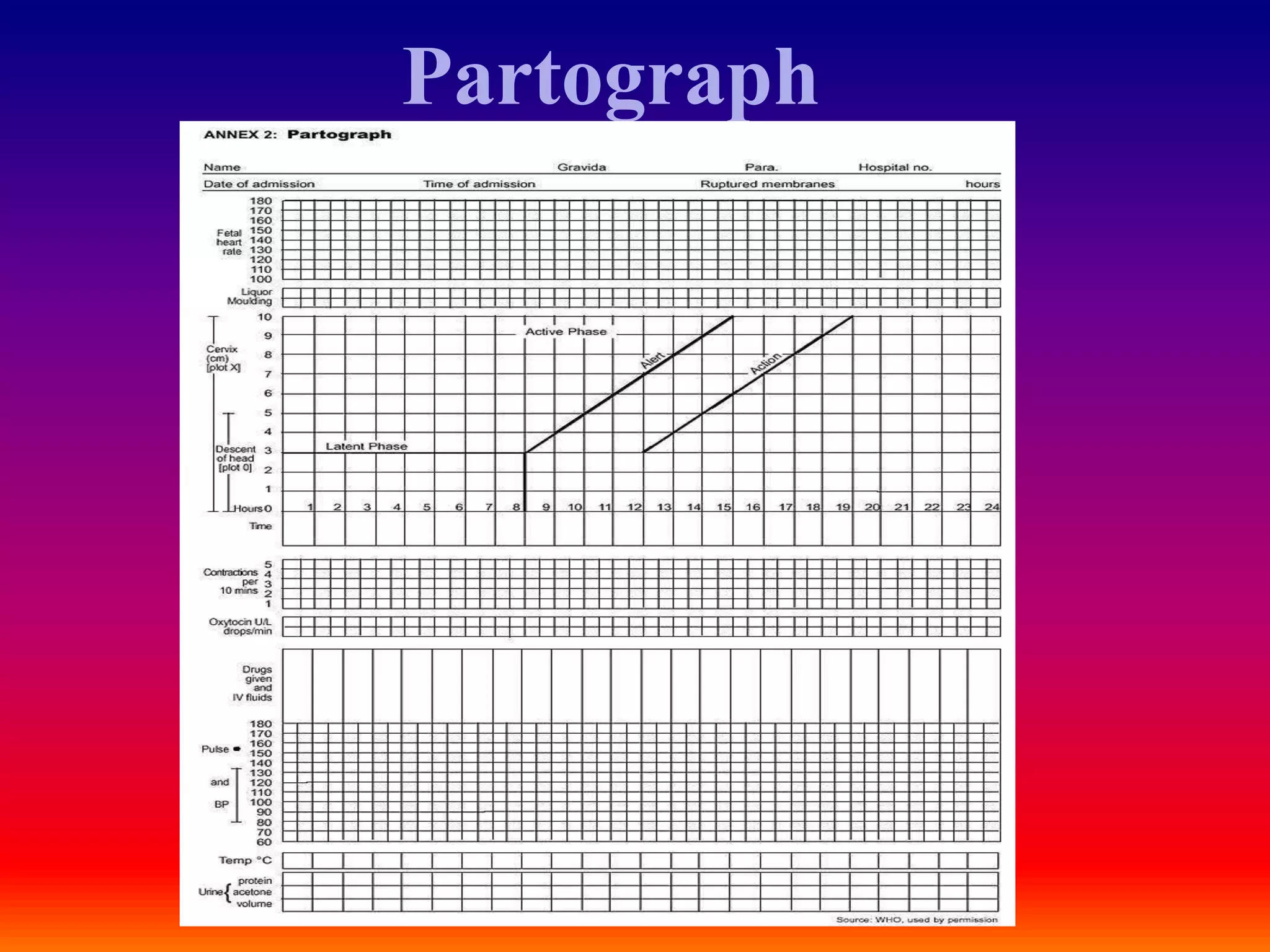 PARTOGRAPH IN MANAGING LABOUR 2021.ppt | Pregnancy | Reproductive Health