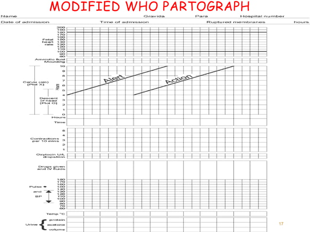Partograph Labour abnormalities1_2.ppt