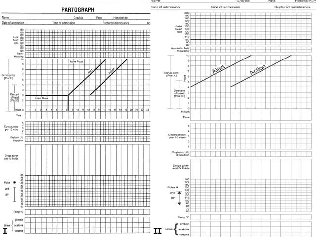 Partograph Labour abnormalities1_2.ppt