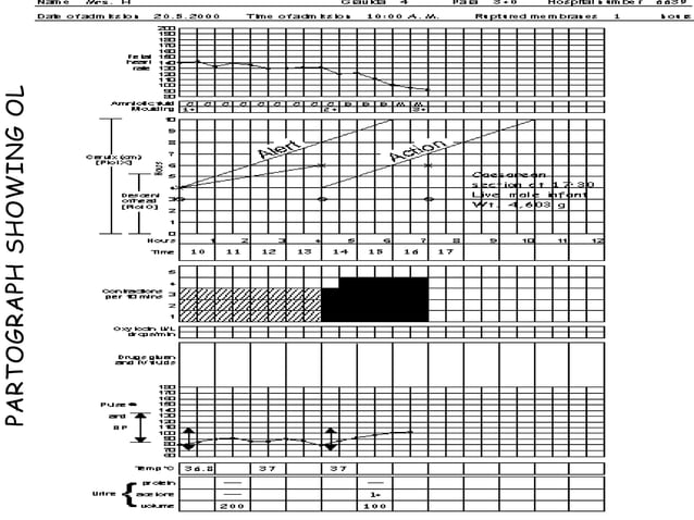 Partograph Labour abnormalities1_2.ppt