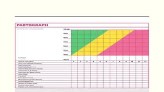 PARTOGRAPH in Midwifery PracticePPT.pptx