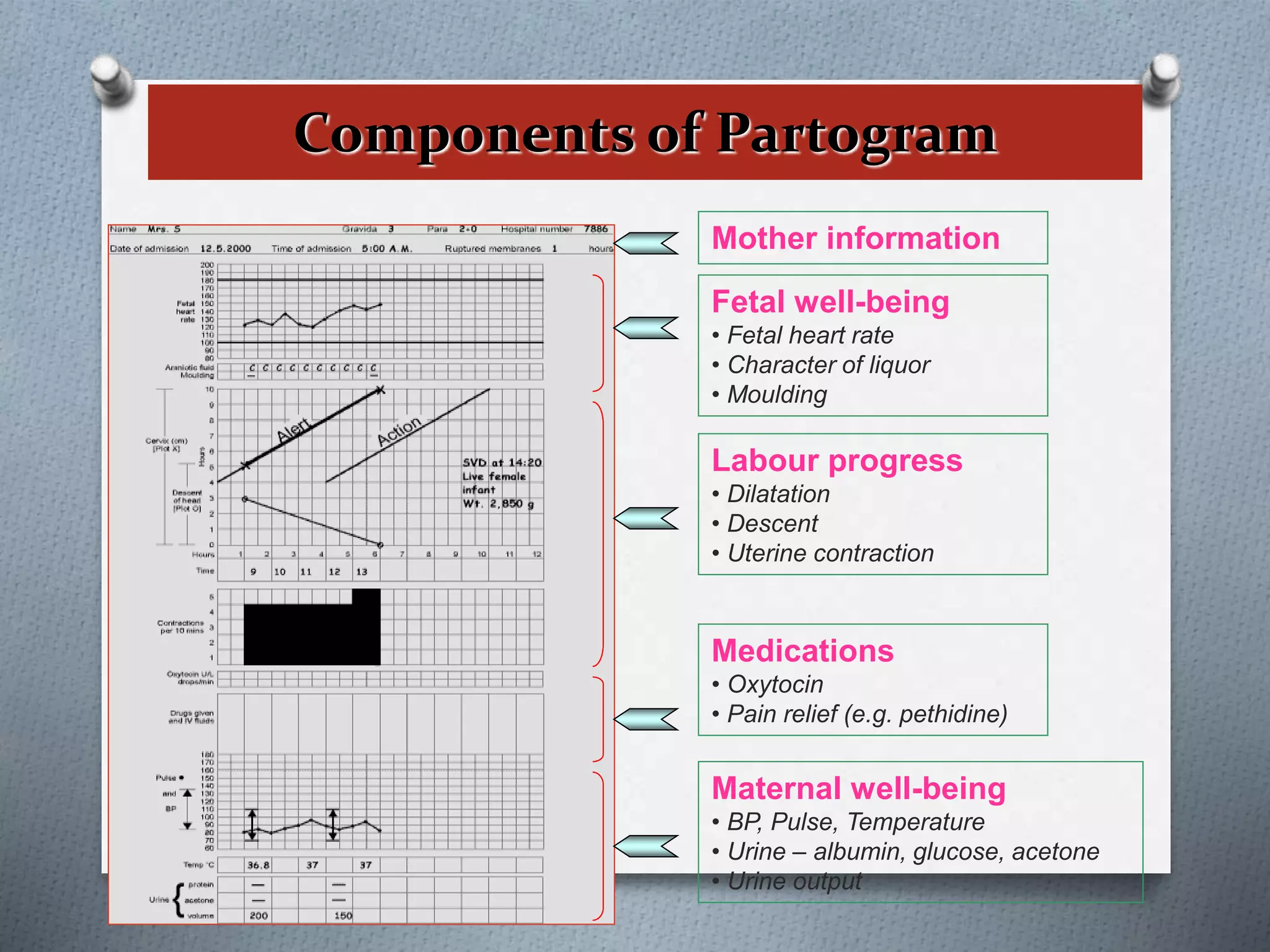Partograph | PPTX