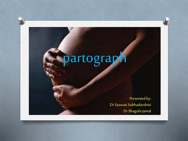 Partograph | PPTX