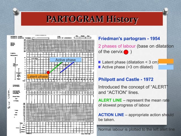 Partograph | PPTX