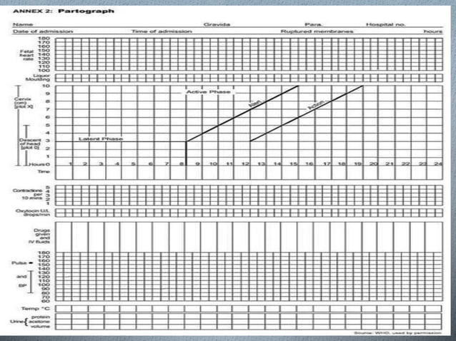 Partograph | PPTX