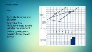Partograph | PPT