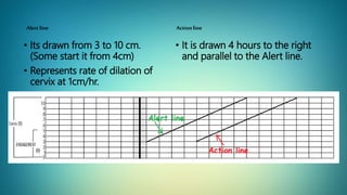 Partograph | PPTX