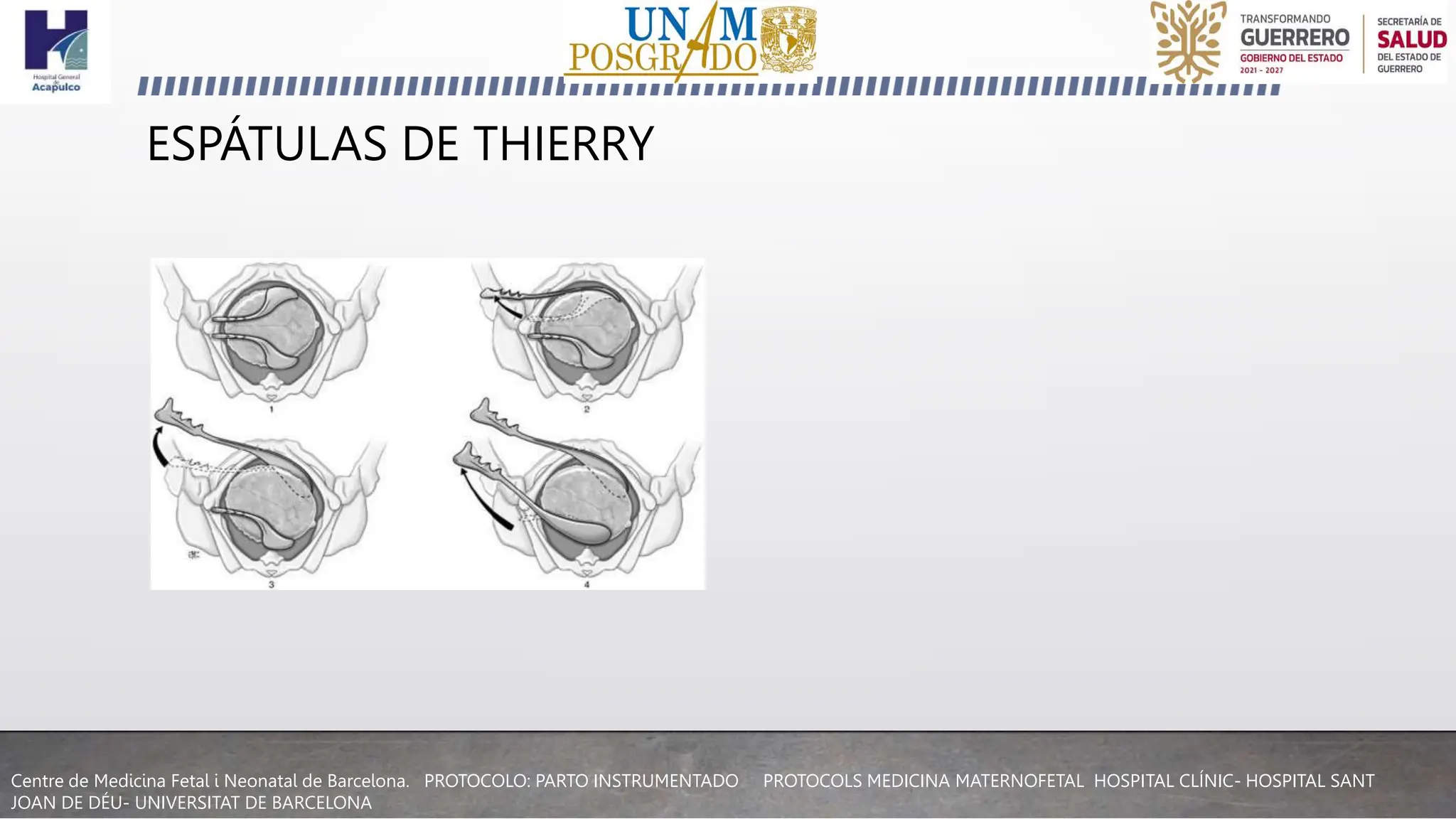 parto instrumentado.en ginecologia y Obstetricia ia | PPTX | Pregnancy ...