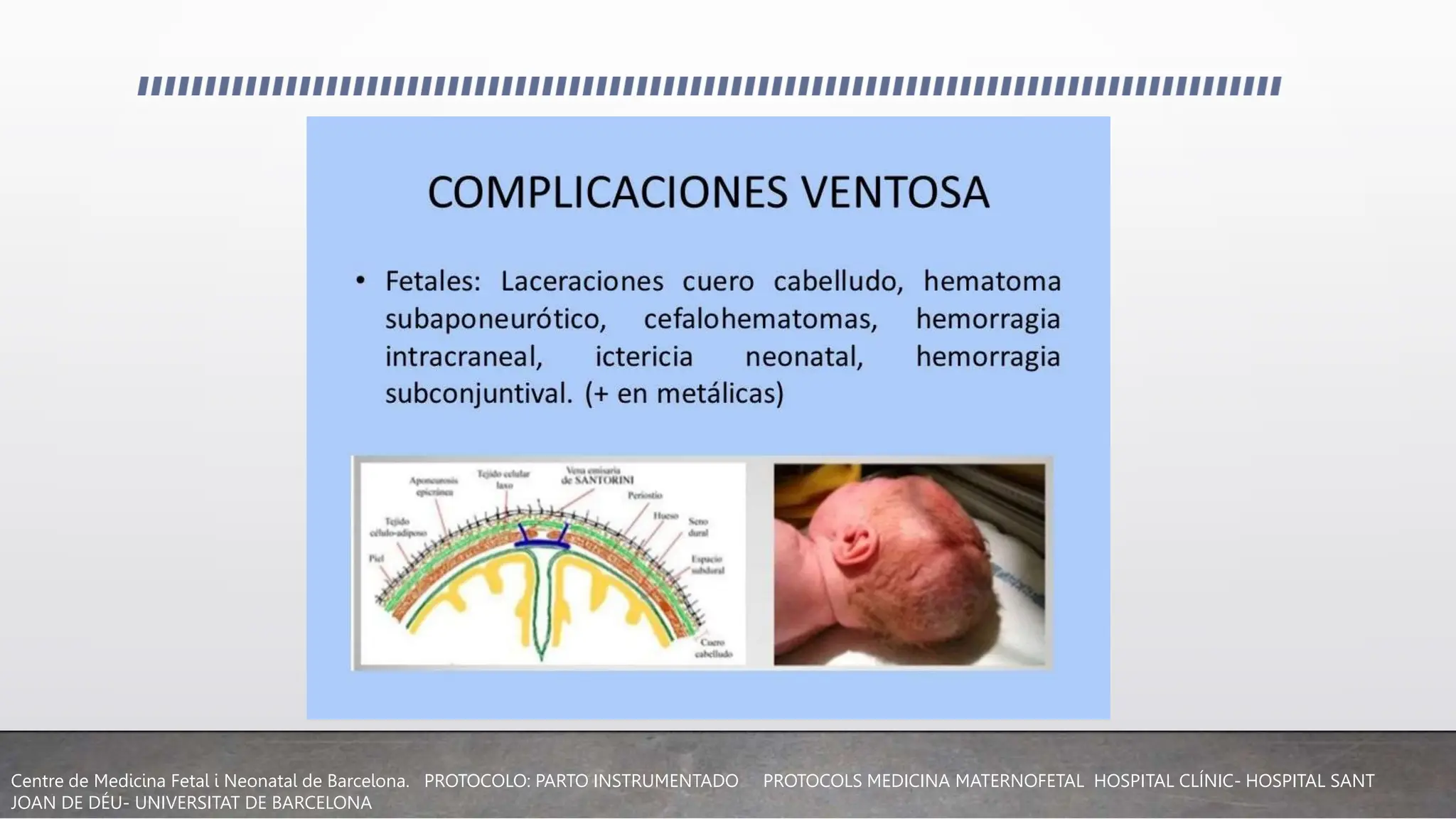 parto instrumentado.en ginecologia y Obstetricia ia | PPTX | Pregnancy ...