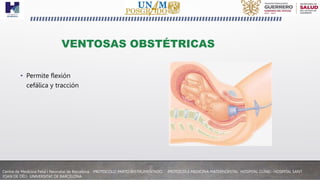 parto instrumentado.en ginecologia y Obstetricia ia | PPTX