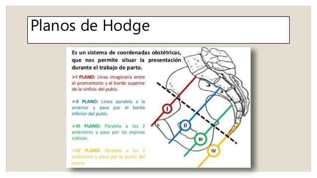 Planos De Hodge