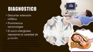Atencion del trabajo de parto en presentacion podalica | PPTX