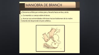 parto pélvico. Y sus mecanismos y maniobras | PPTX