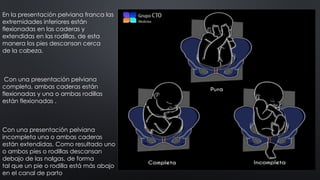 parto pélvico. Y sus mecanismos y maniobras | PPTX