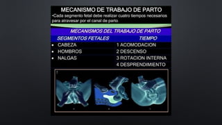 parto pélvico. Y sus mecanismos y maniobras | PPTX