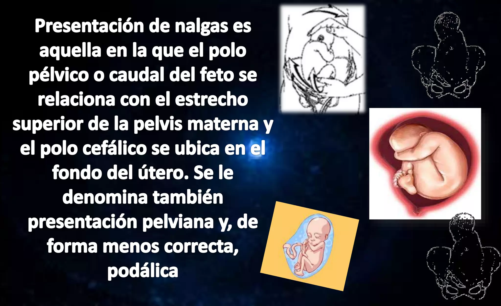 Parto en presentacion podalica | PPTX