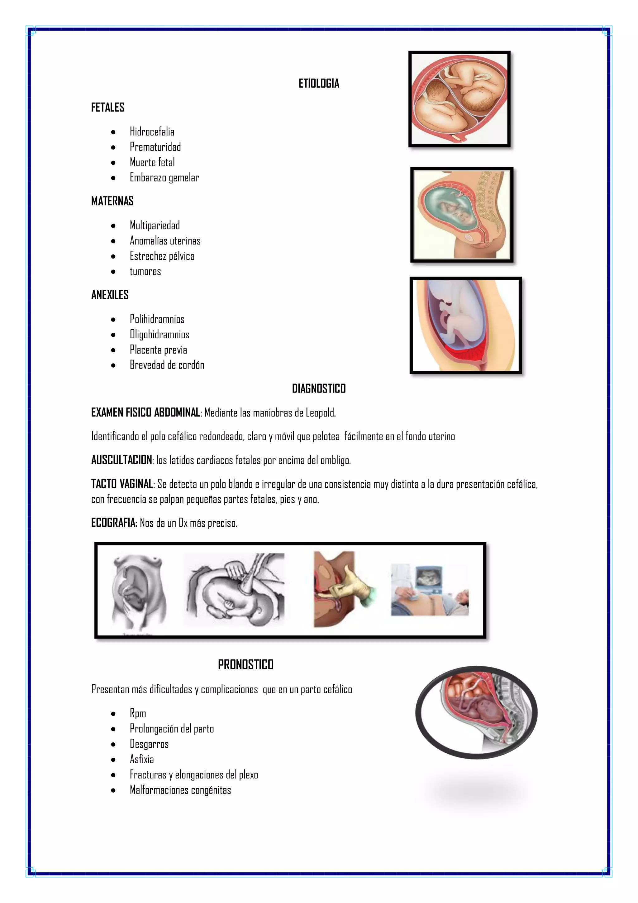 Parto podalico | PDF