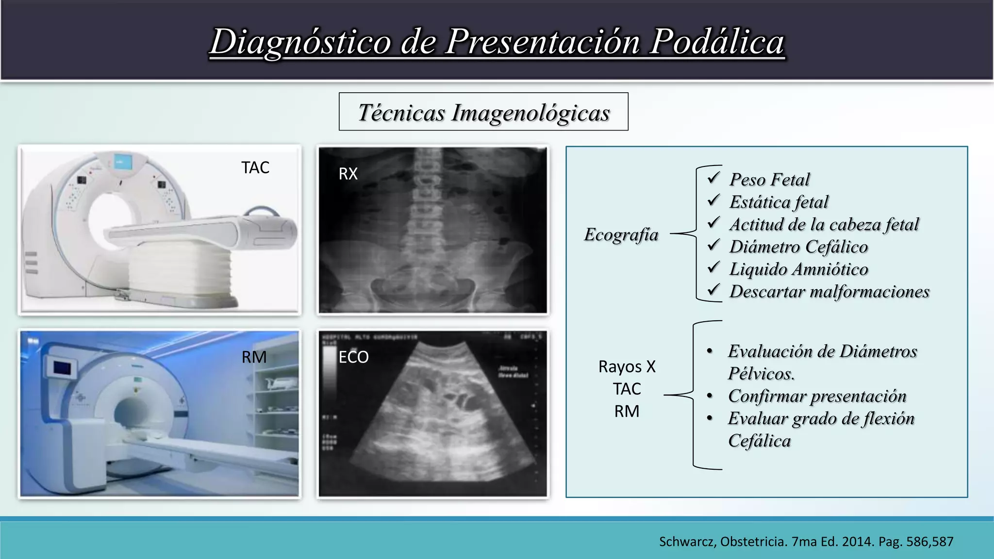 Parto podalico | PPTX