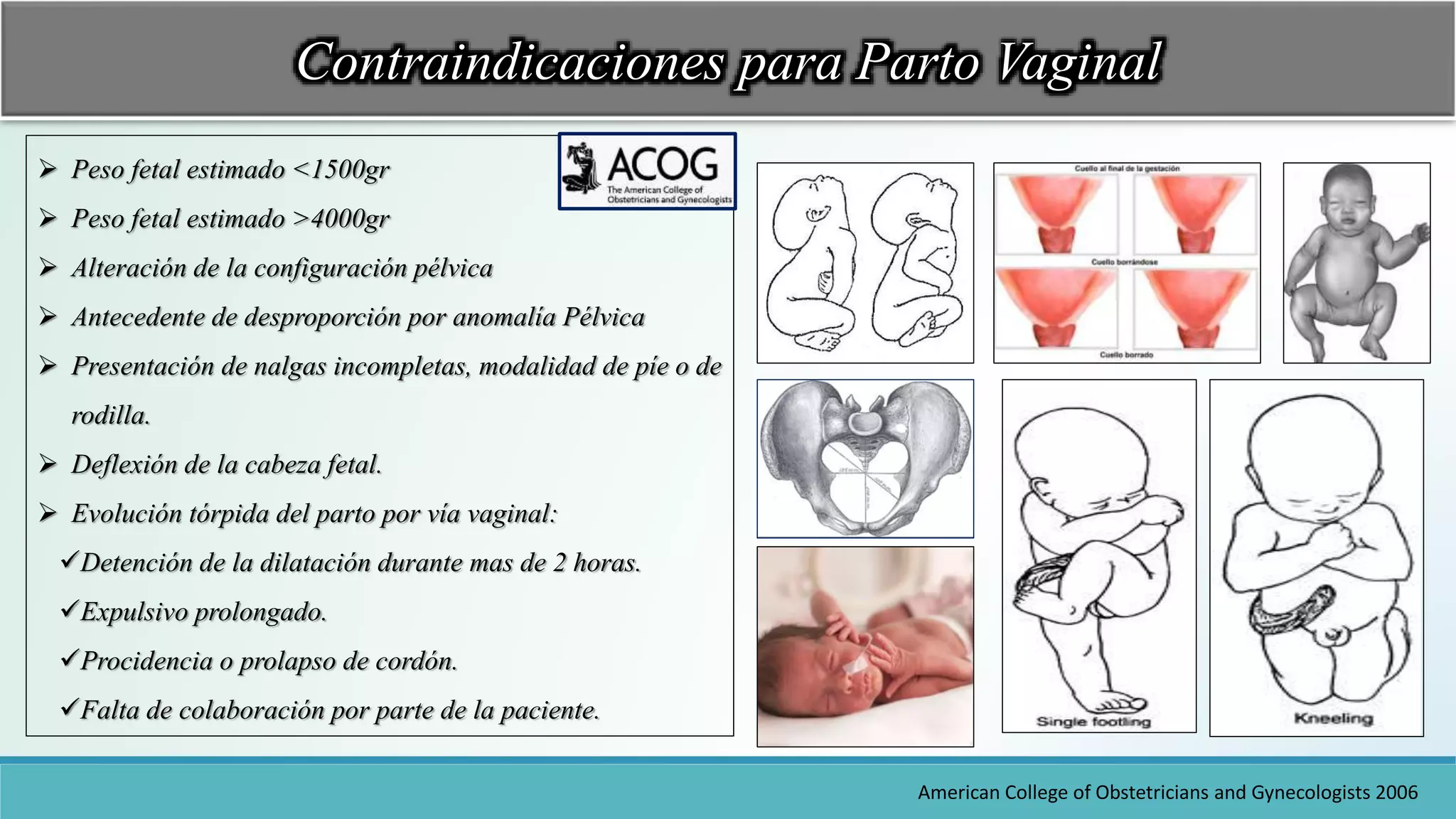 Parto podalico | PPTX