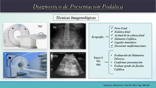 Parto podalico | PPTX
