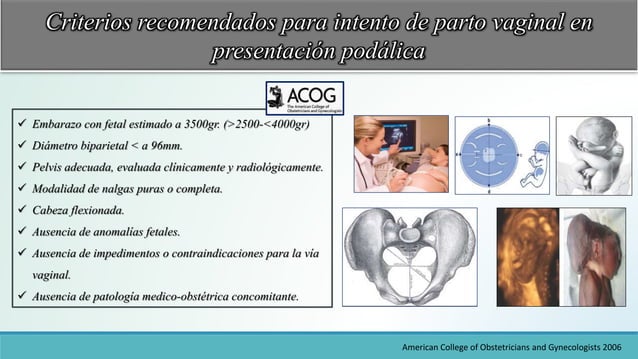 Parto podalico | PPTX
