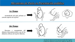 Parto podalico | PPTX